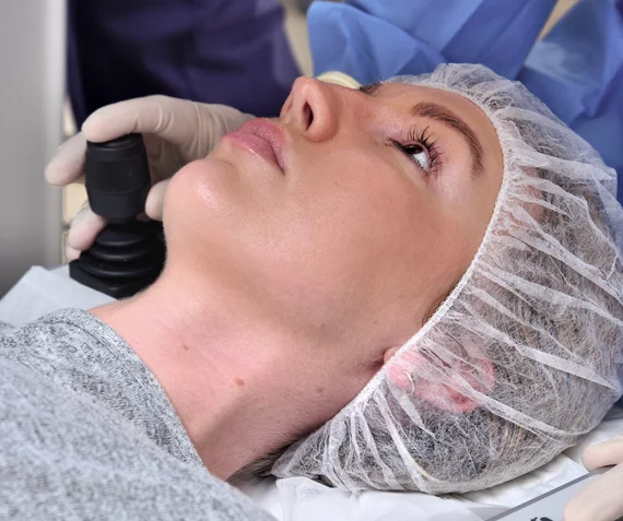 Implantable Contact Lens Surgery to achieve 20:20 vision